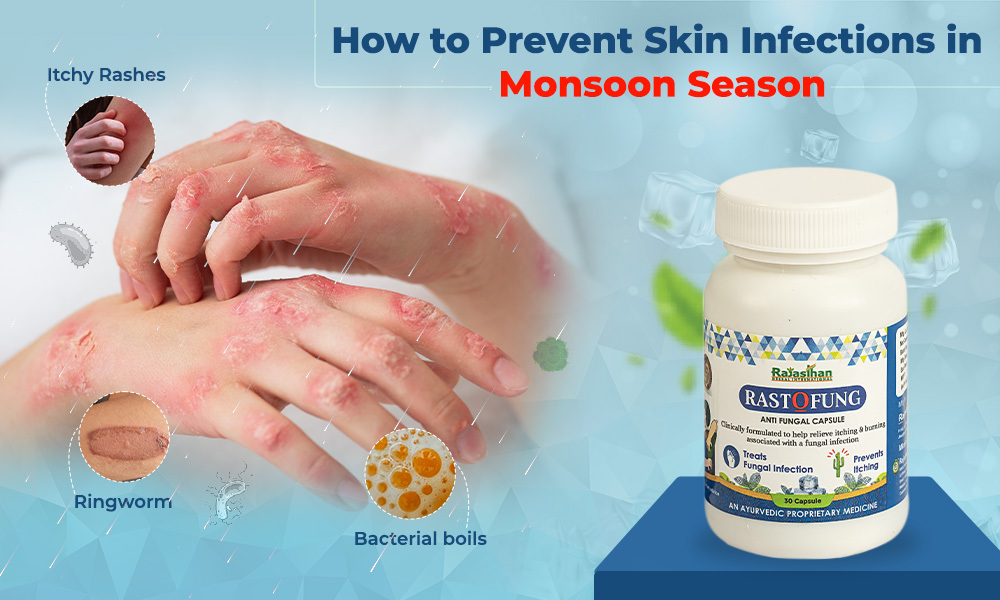 How to Prevent Skin Infections in Monsoon | Ayurvedic & Hygiene